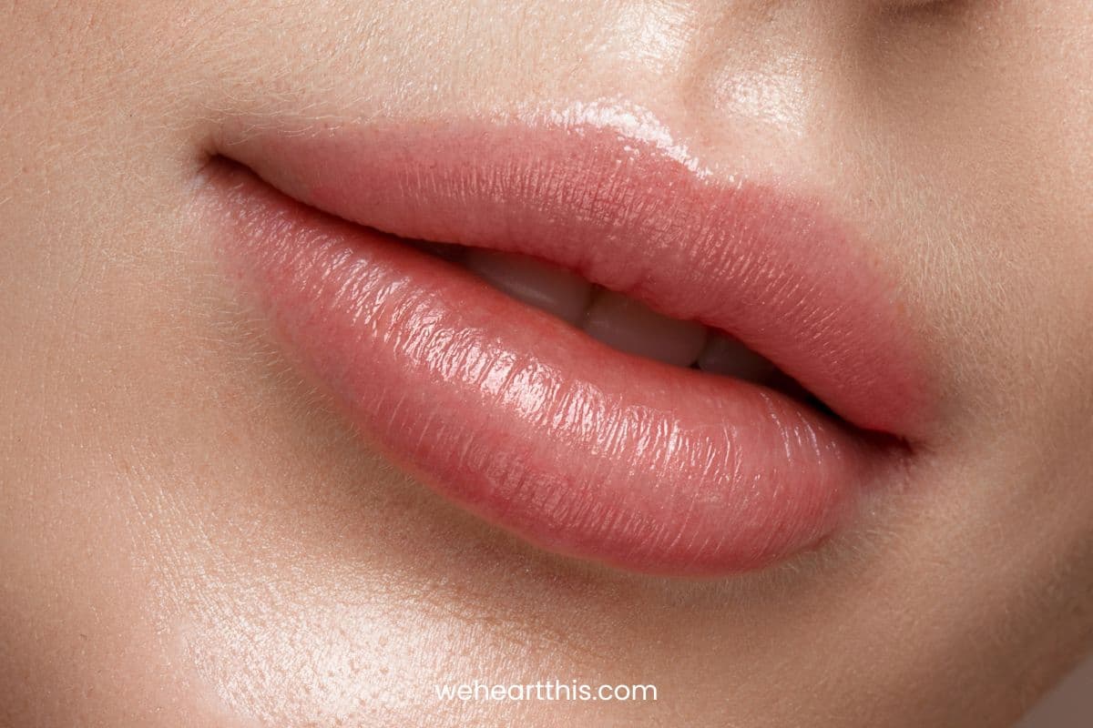 Lip Flip vs Filler: Choosing the Perfect Lip Enhancement Procedure