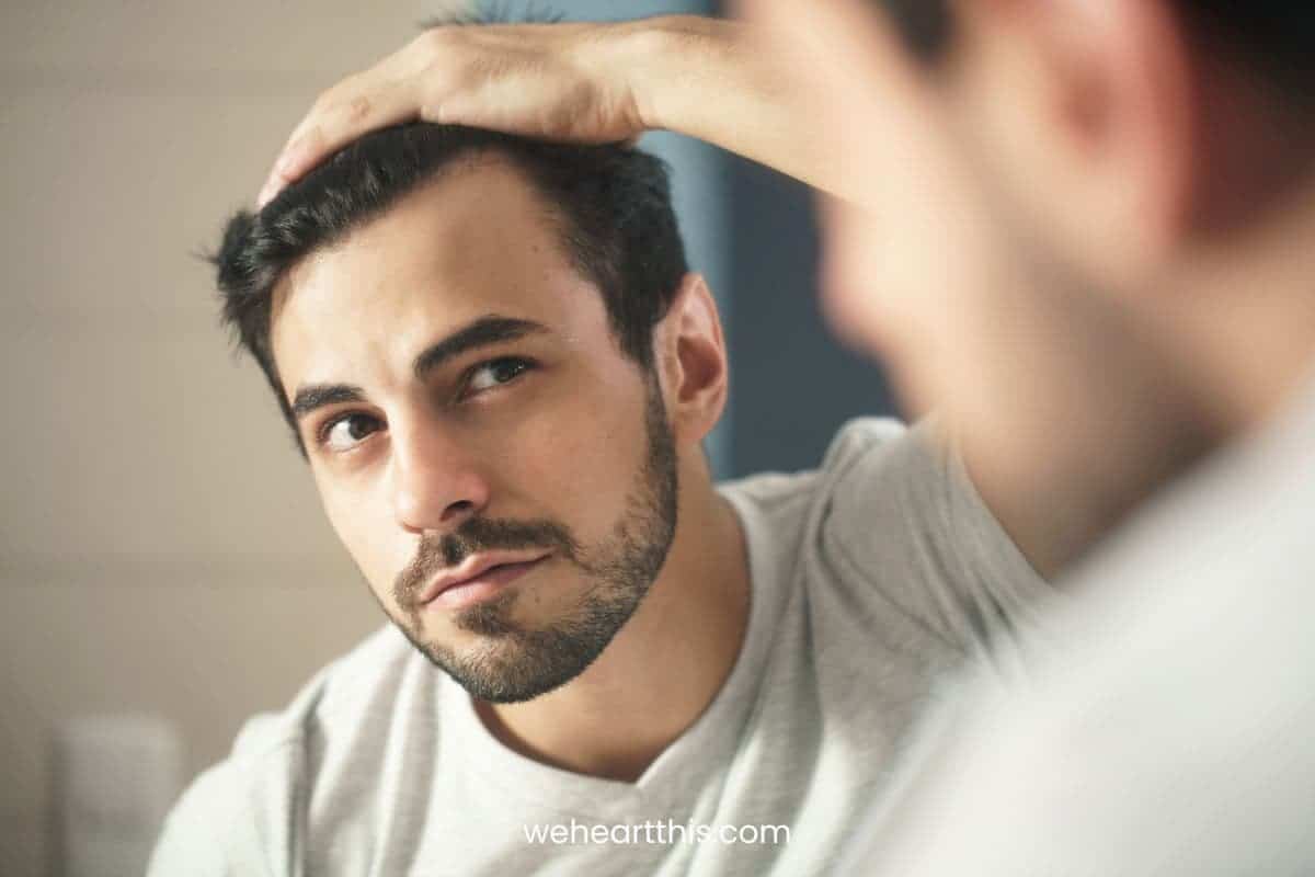 Types of Hairlines in Men and Women + How To Protect Them