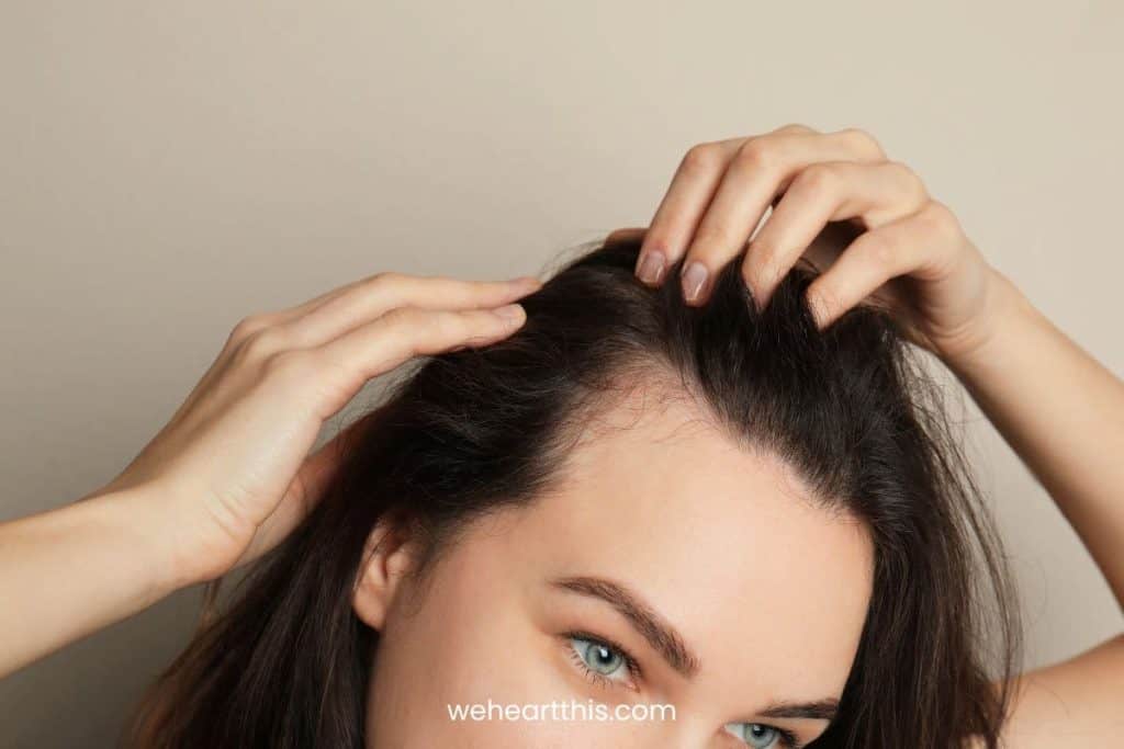 Types of Hairlines in Men and Women + How To Protect Them