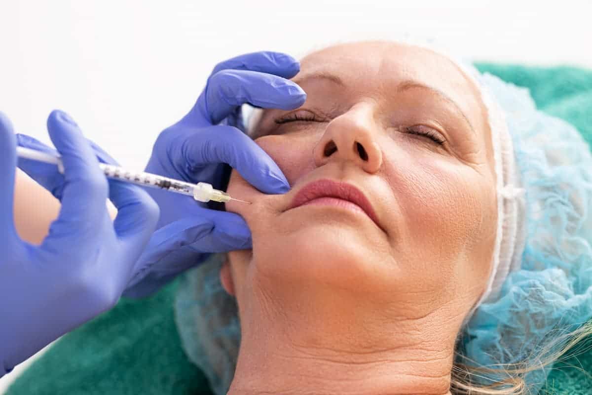 What Are Marionette Lines? 9 Ways To Get Rid of Them