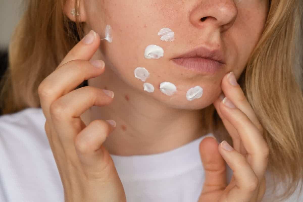 24 Incredible The Ordinary Products for Hyperpigmentation
